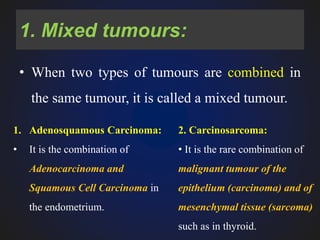 neoplasia introduction, nomenclature, classification of tumours | PPTX