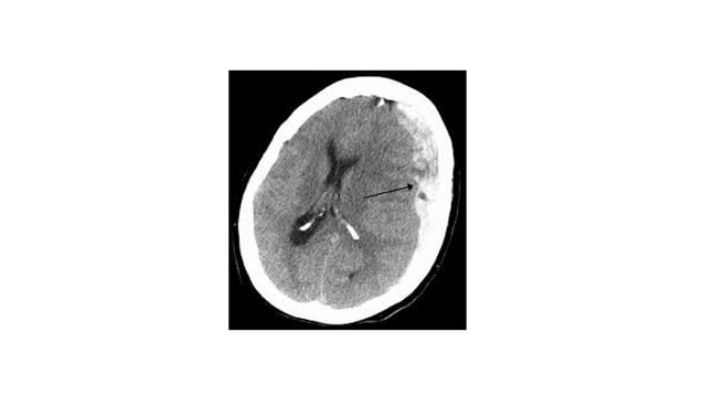 1) Neurosurgery / neuro/ brain tissues dissection | PPT