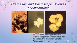 Nocardia, Actinomyces and Streptomyces | PPTX
