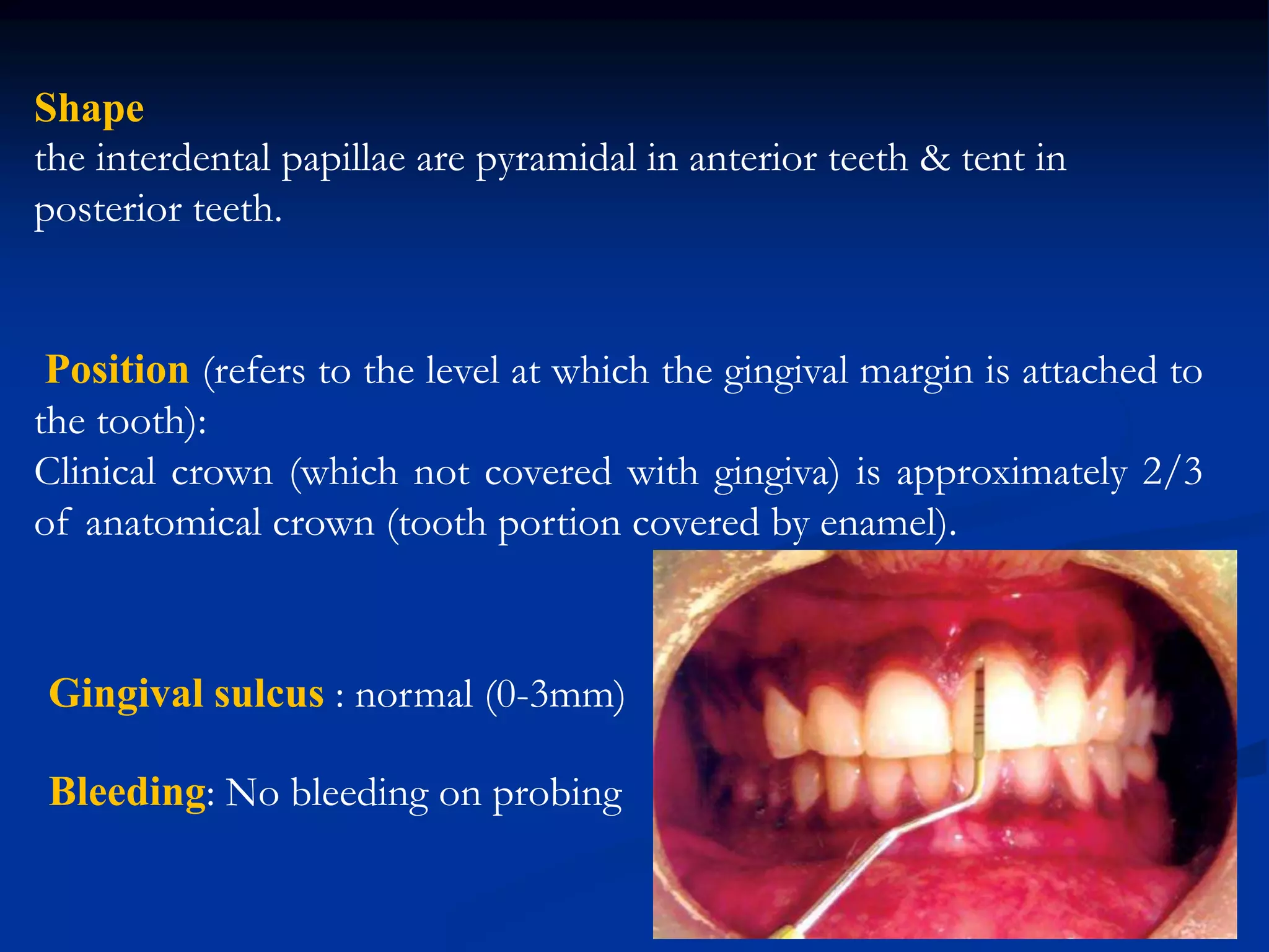 1 normal periodontium.ppt