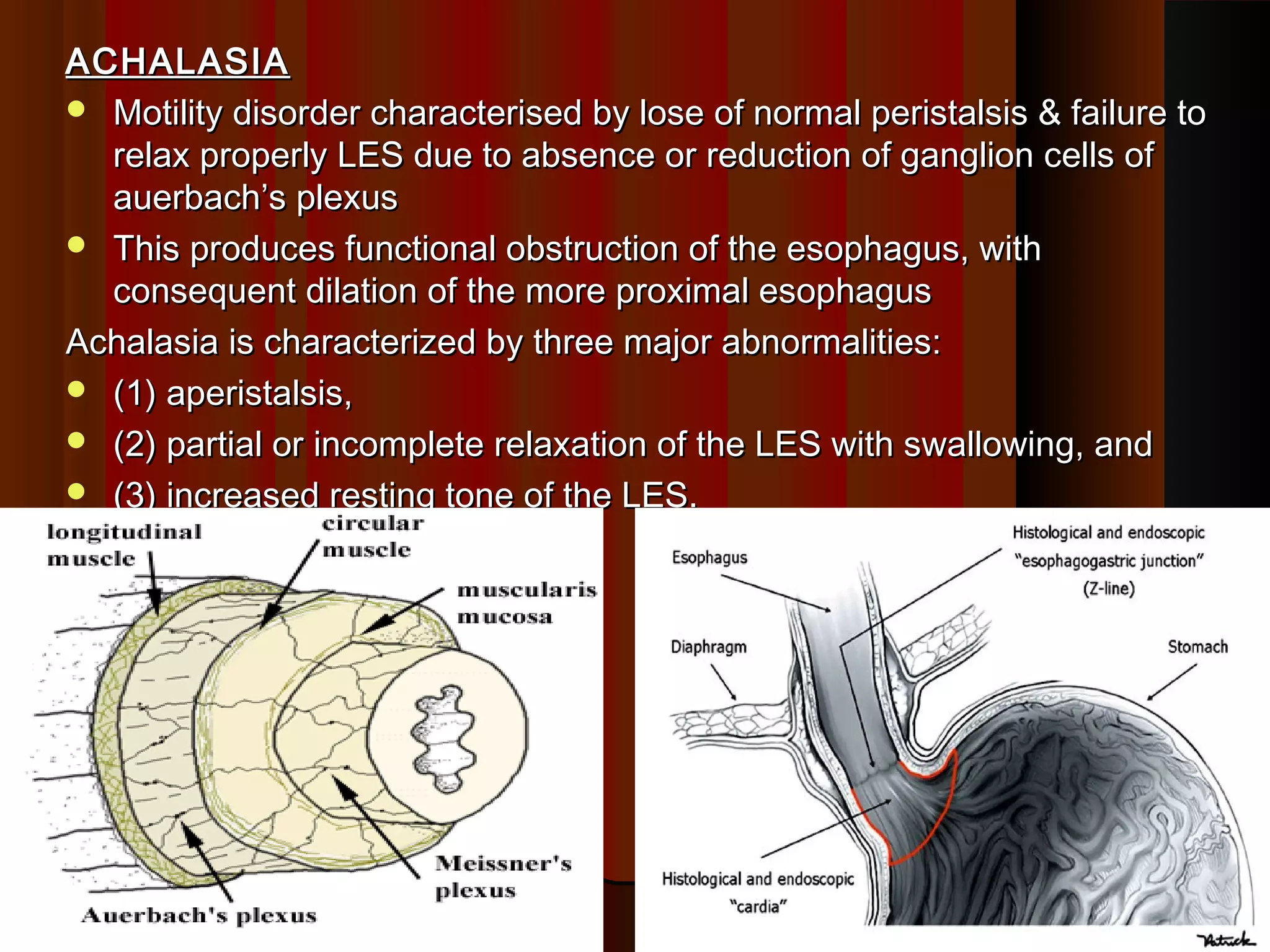 1oesophagus | PPT