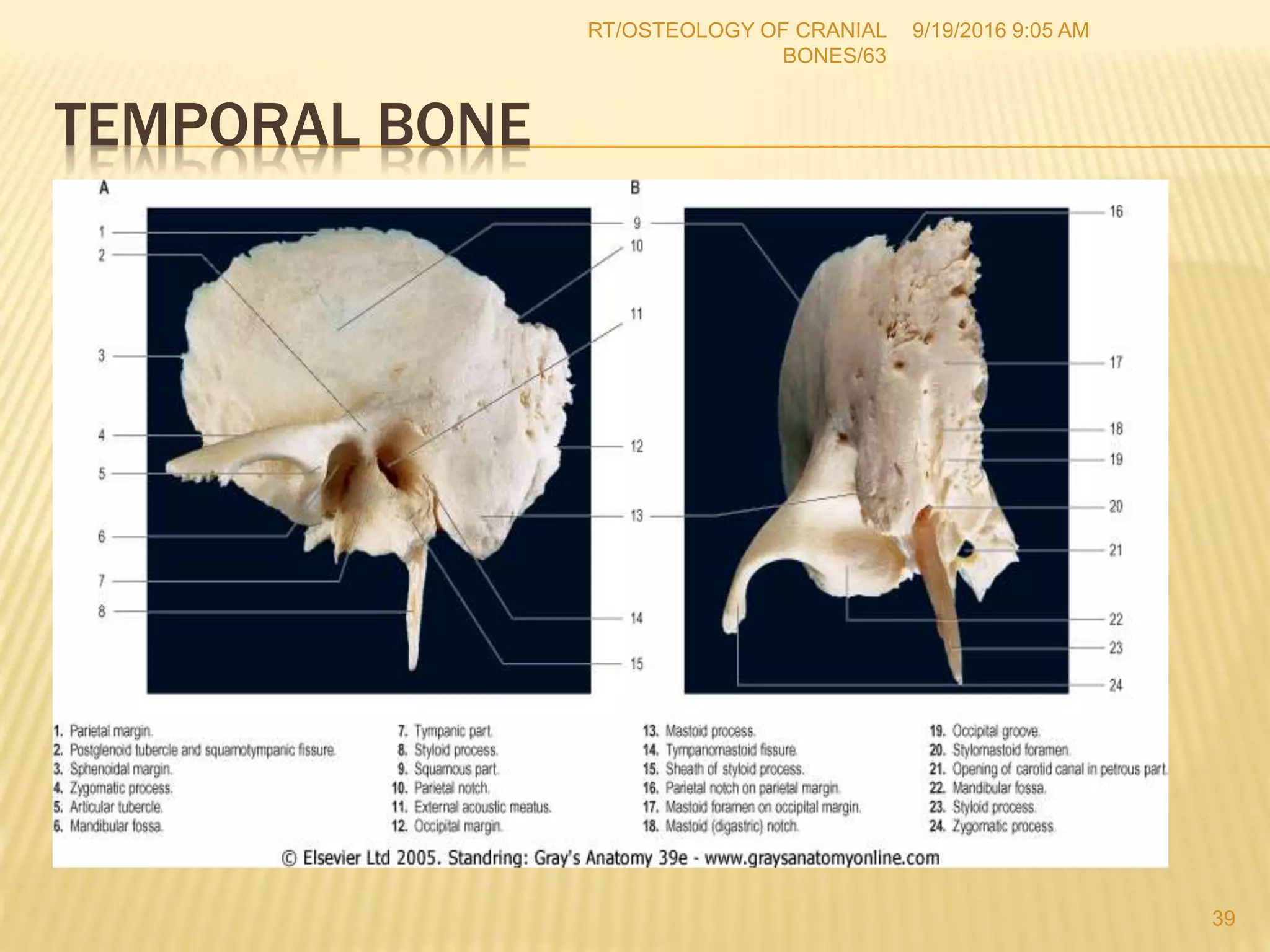 1 osteology of cranial bones rt(67) Dr. RAHUL TIWARI | PPTX