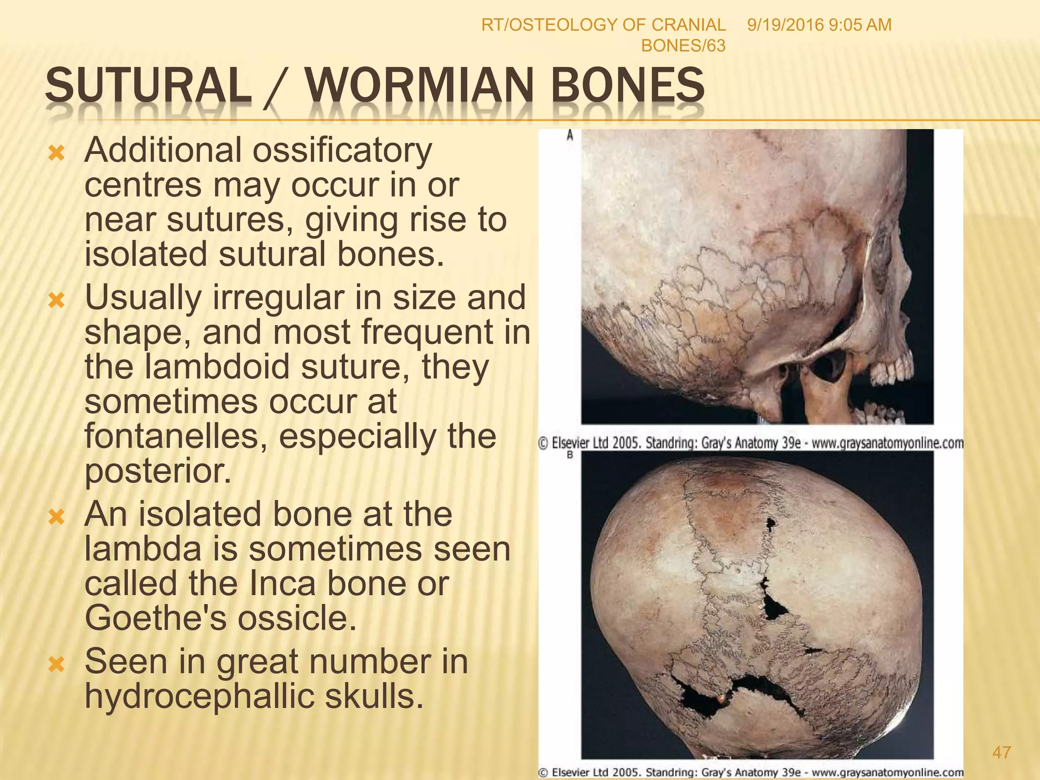 1 osteology of cranial bones rt(67) Dr. RAHUL TIWARI | PPTX