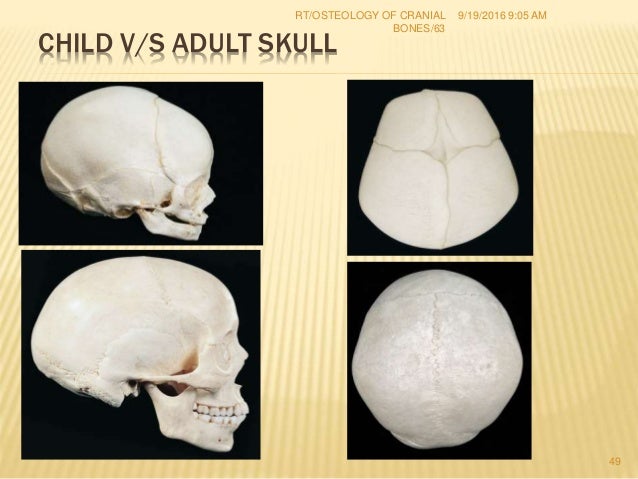 1 osteology of cranial bones rt(67) Dr. RAHUL TIWARI