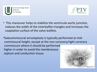 Aortic valve repair | PPT