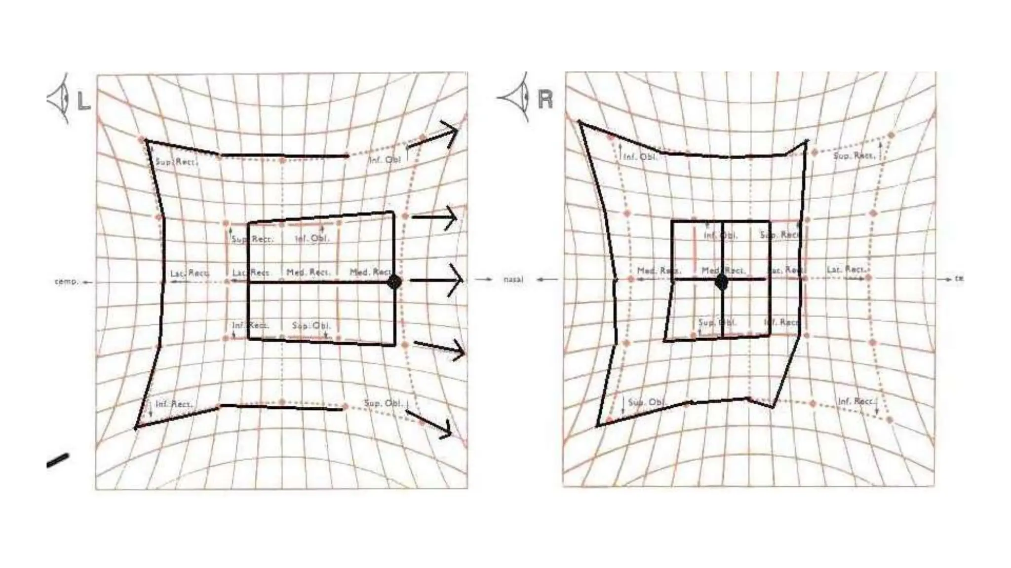 Diplopia_Chart_and_Hess_Chart.pptx