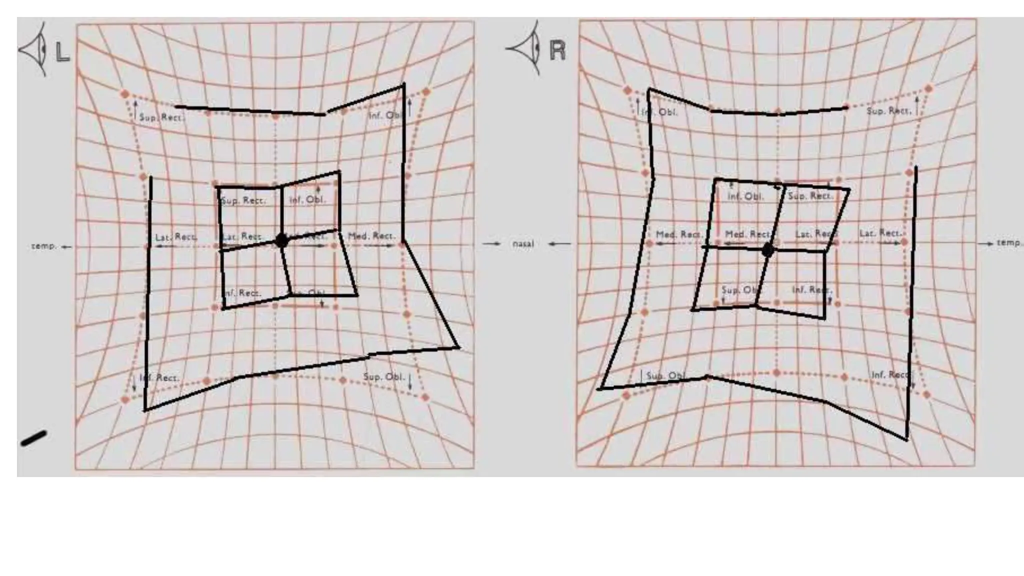 Diplopia_Chart_and_Hess_Chart.pptx