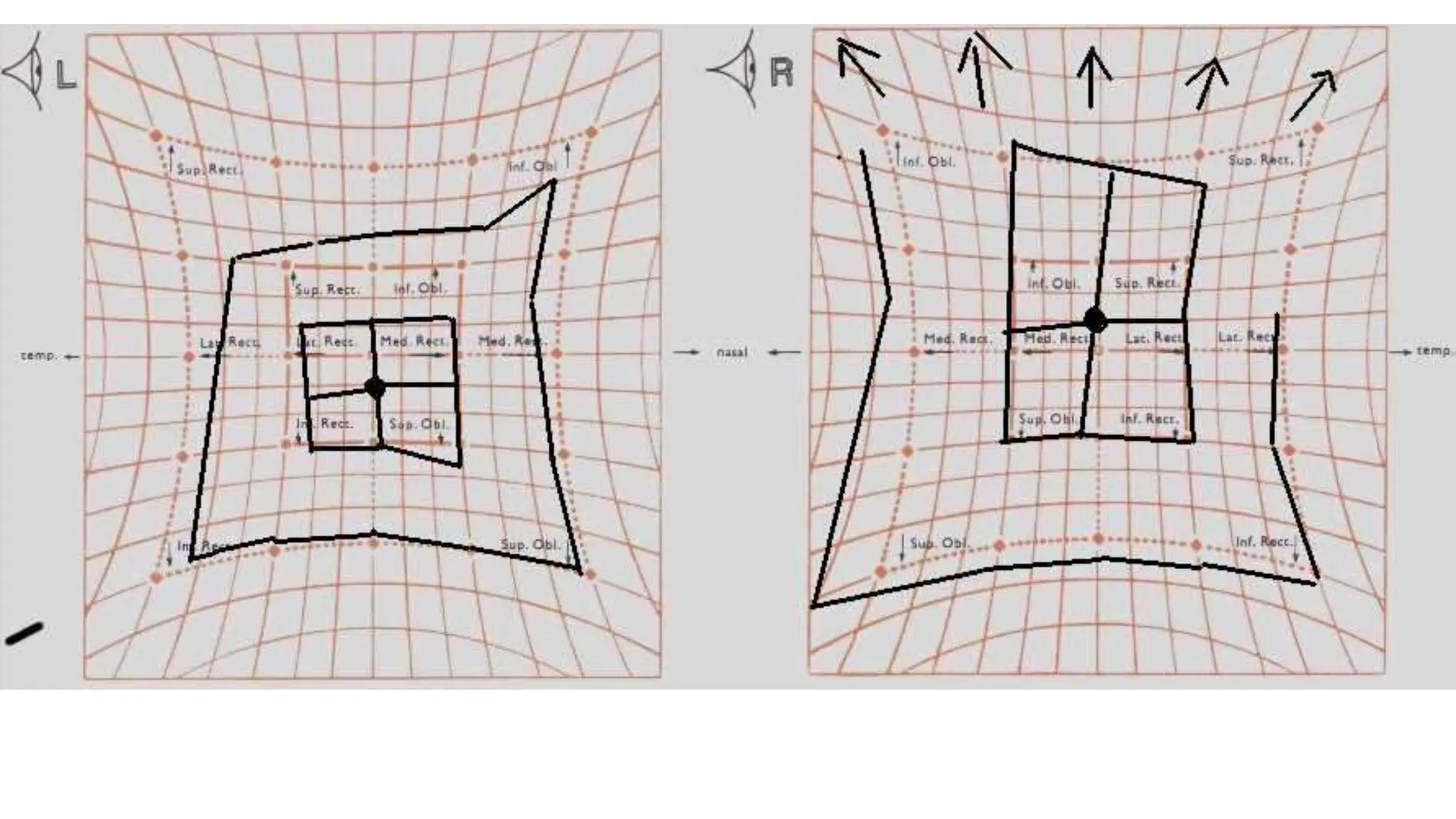 Diplopia_Chart_and_Hess_Chart.pptx