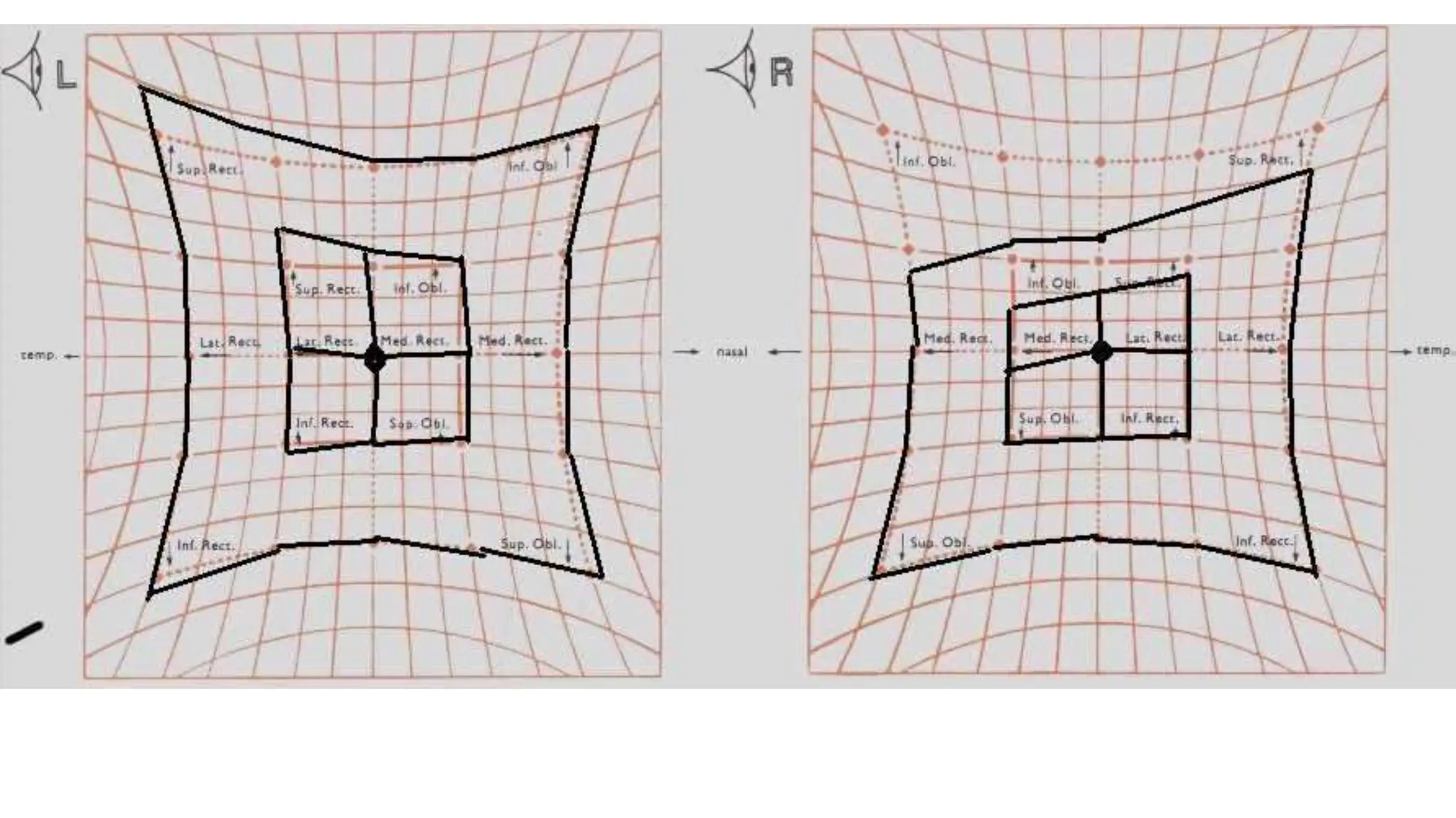 Diplopia_Chart_and_Hess_Chart.pptx