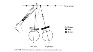 Diplopia_Chart_and_Hess_Chart.pptx