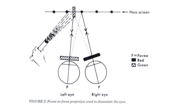 Diplopia_Chart_and_Hess_Chart.pptx