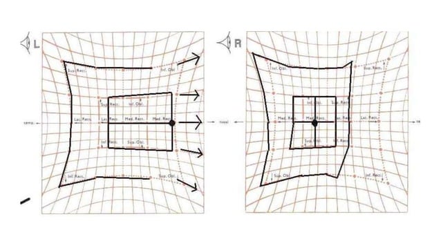 Diplopia_Chart_and_Hess_Chart.pptx