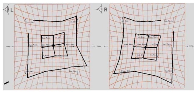 Diplopia_Chart_and_Hess_Chart.pptx
