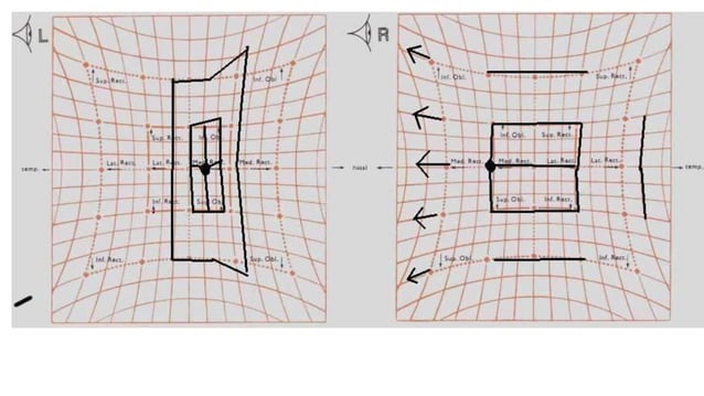 Diplopia_Chart_and_Hess_Chart.pptx