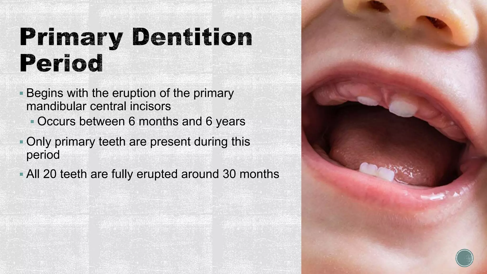 Overview of Dentitions | PPTX