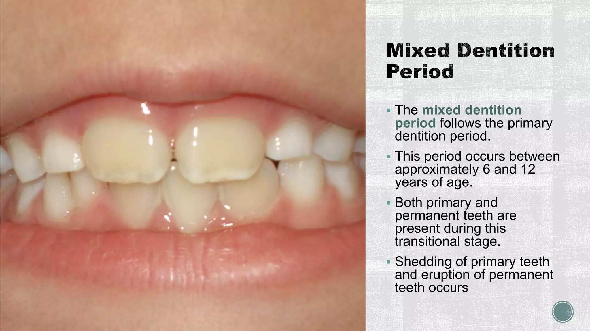 Overview of Dentitions | PPTX