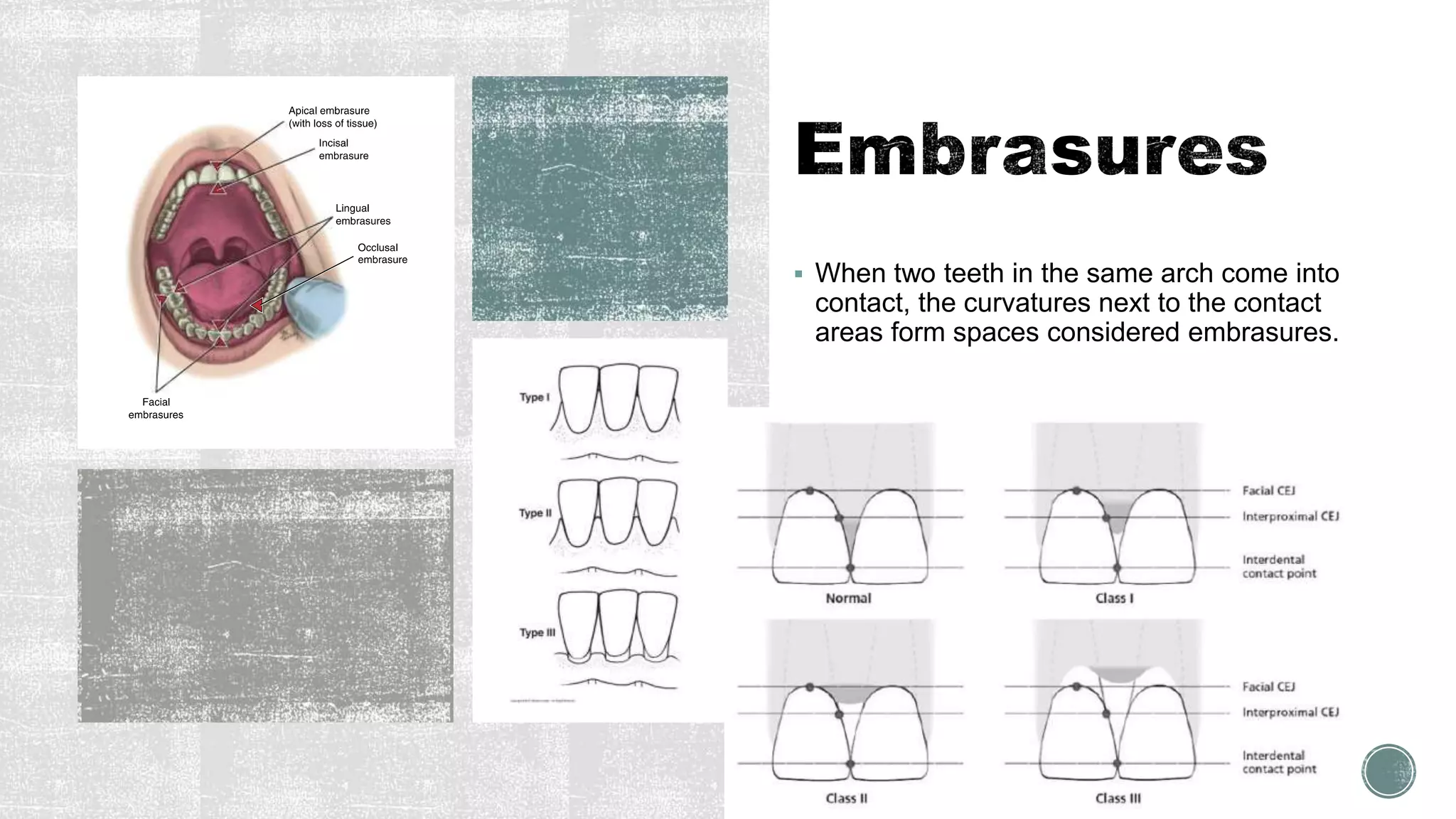 Overview of Dentitions | PPTX