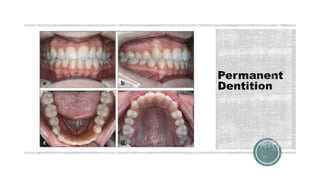 Overview of Dentitions | PPTX