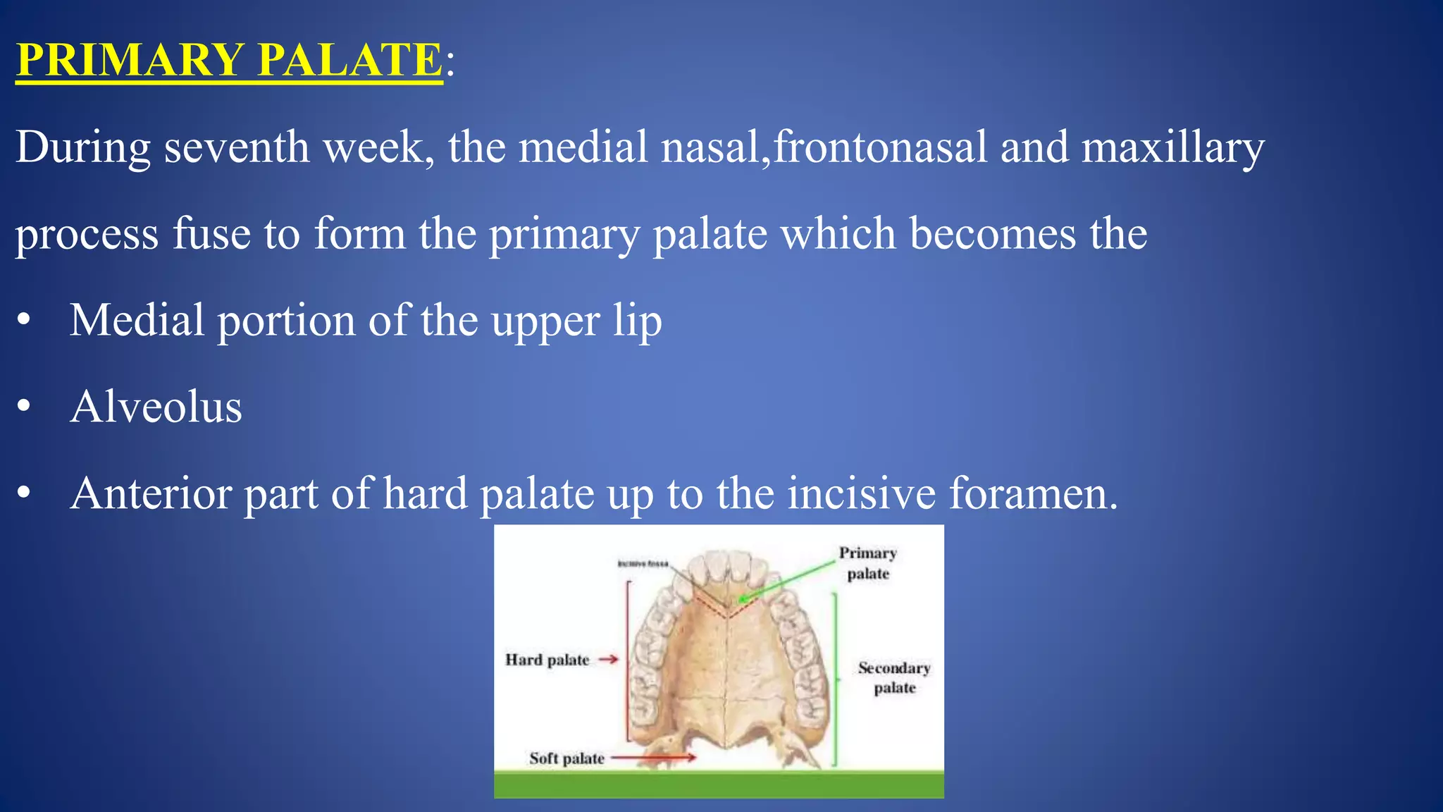 DEVELOPMENT OF PALATE AND ITS ANOMALIES | PPTX