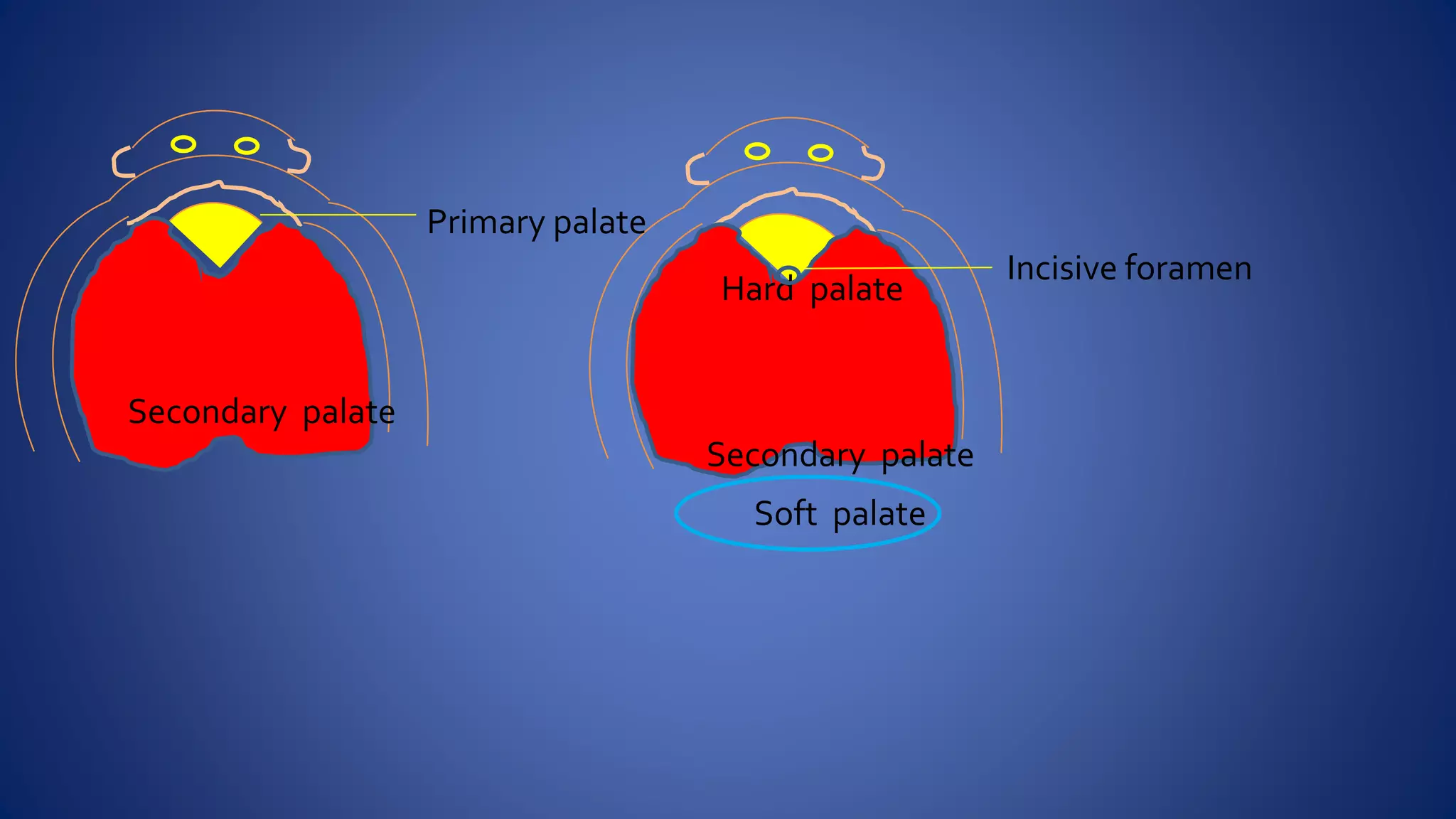 DEVELOPMENT OF PALATE AND ITS ANOMALIES | PPTX