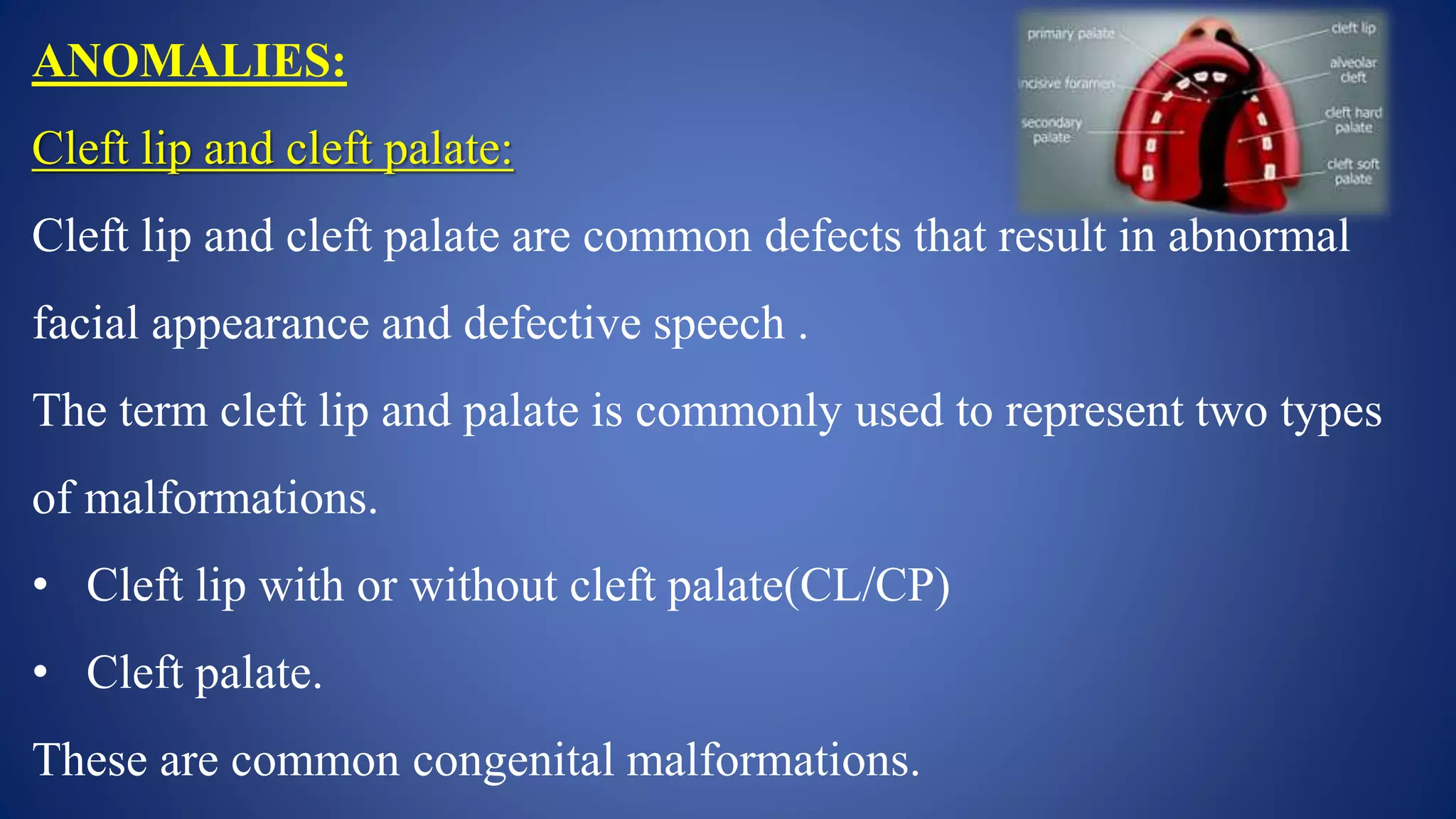 DEVELOPMENT OF PALATE AND ITS ANOMALIES | PPTX