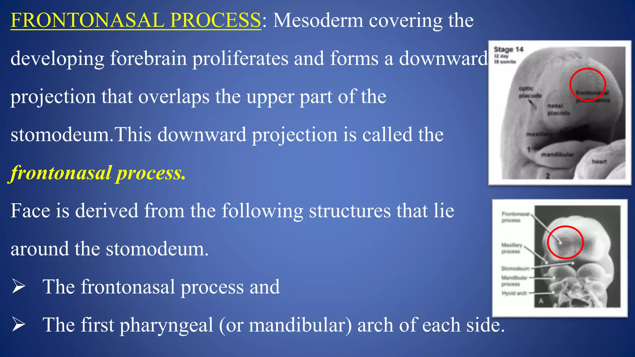 DEVELOPMENT OF PALATE AND ITS ANOMALIES | PPTX