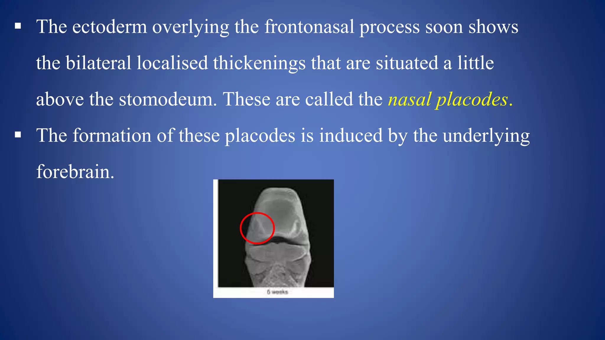 DEVELOPMENT OF PALATE AND ITS ANOMALIES | PPTX