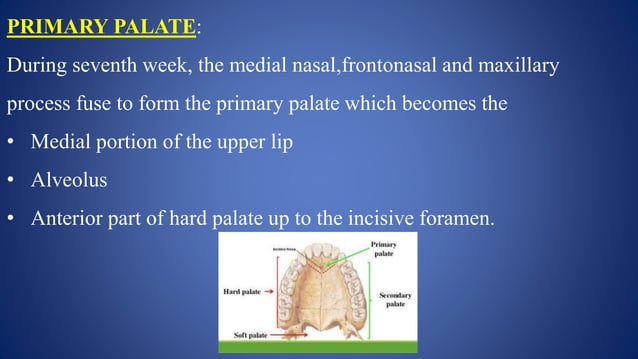DEVELOPMENT OF PALATE AND ITS ANOMALIES | PPTX