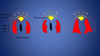 DEVELOPMENT OF PALATE AND ITS ANOMALIES | PPTX
