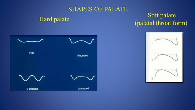 DEVELOPMENT OF PALATE AND ITS ANOMALIES | PPTX