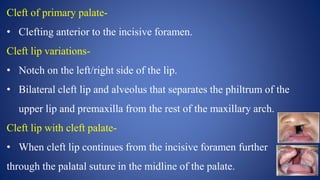 DEVELOPMENT OF PALATE AND ITS ANOMALIES | PPTX