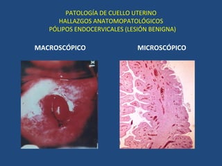 1 patologia de cuello uterino. | PPT