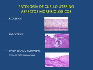 1 patologia de cuello uterino. | PPT