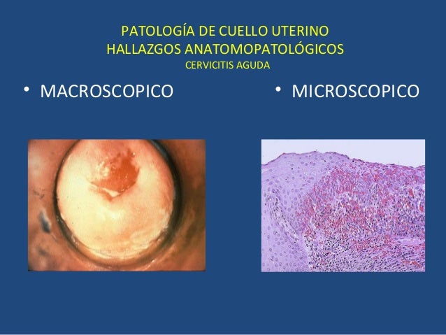 1 patologia de cuello uterino.