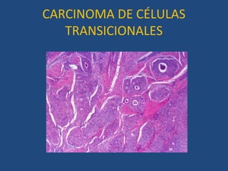 Patologia de pene y vejiga urinaria II | PPT