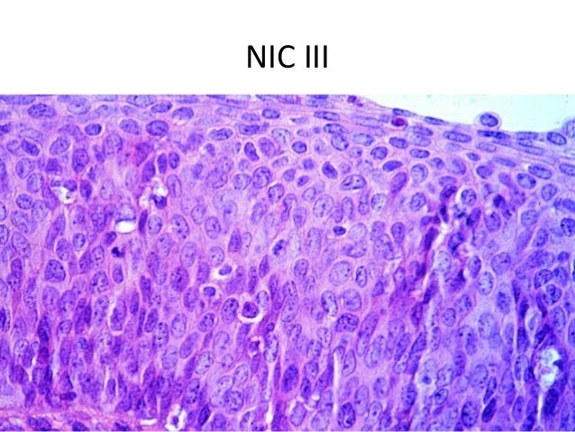 Patología de cuello uterino I