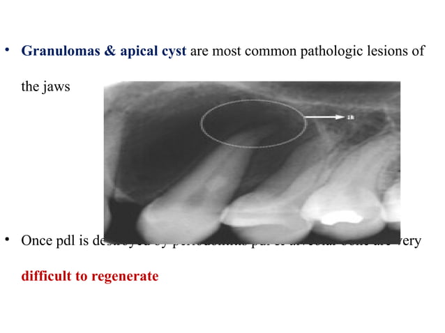 tooth supporting structures and its influence in periodontology | PPT