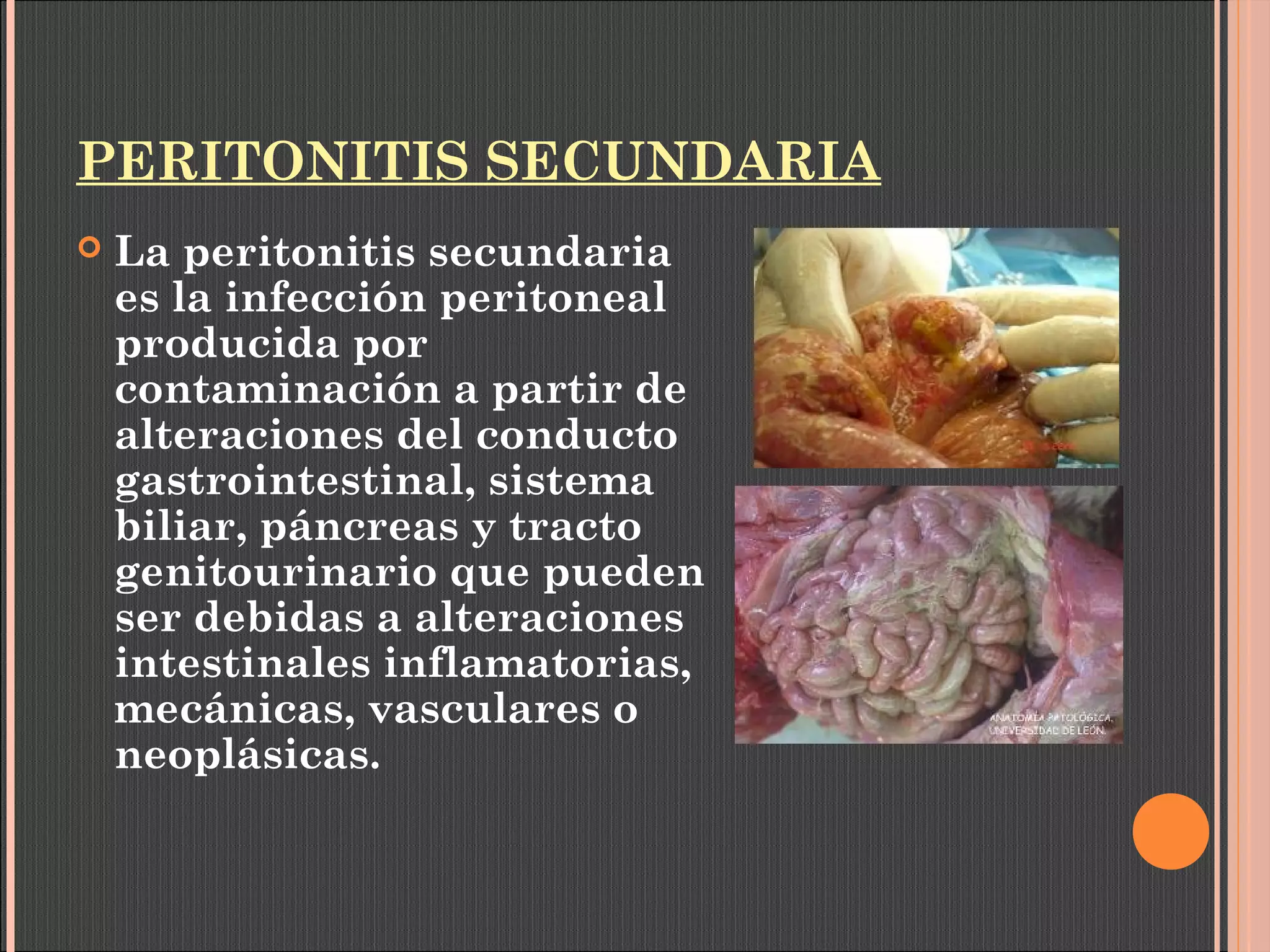 peritonitis secundaria-dx-y-tto | PPT