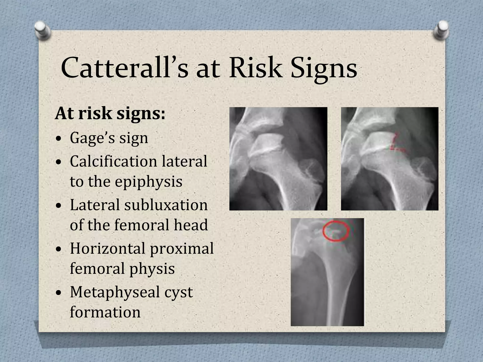 1 perthese diagnosis & classification | PPTX
