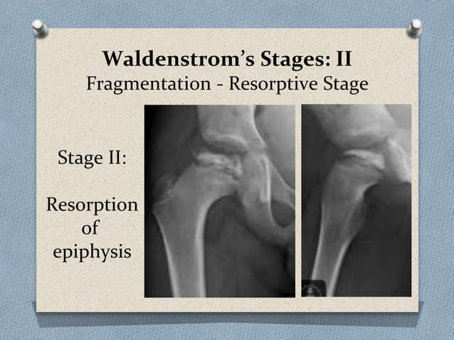 1 perthese diagnosis & classification | PPTX | Bone and Joint ...