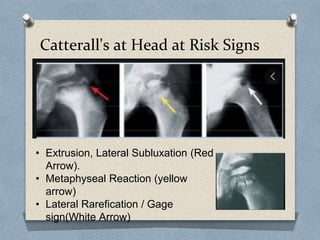 1 perthese diagnosis & classification | PPT