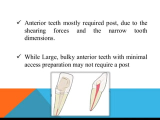 1 Post and core-1 (Muhadharaty)rrrr.pptx