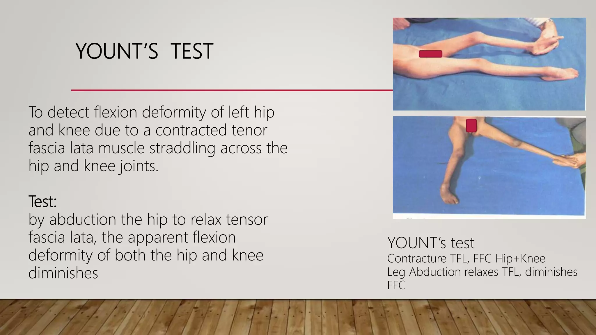Post Polio Residual Palsy: Pathophysiology & Principles of Rx | PPTX