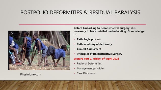Post Polio Residual Palsy: Pathophysiology & Principles of Rx | PPT