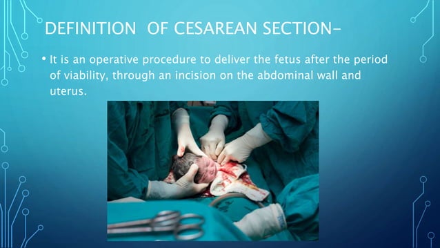 Pregnancy with previous cesarean section | PPTX | Pregnancy ...