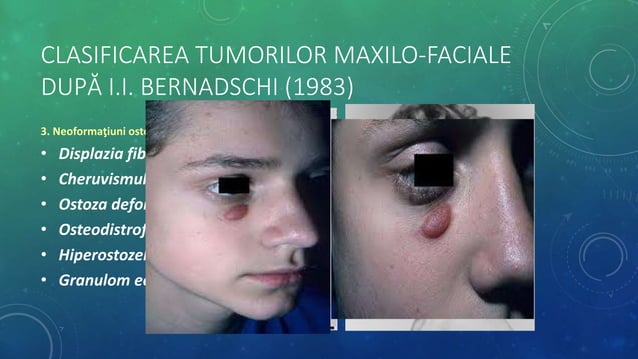 1 prelegere tumori clasificare.ppt....... | PPT