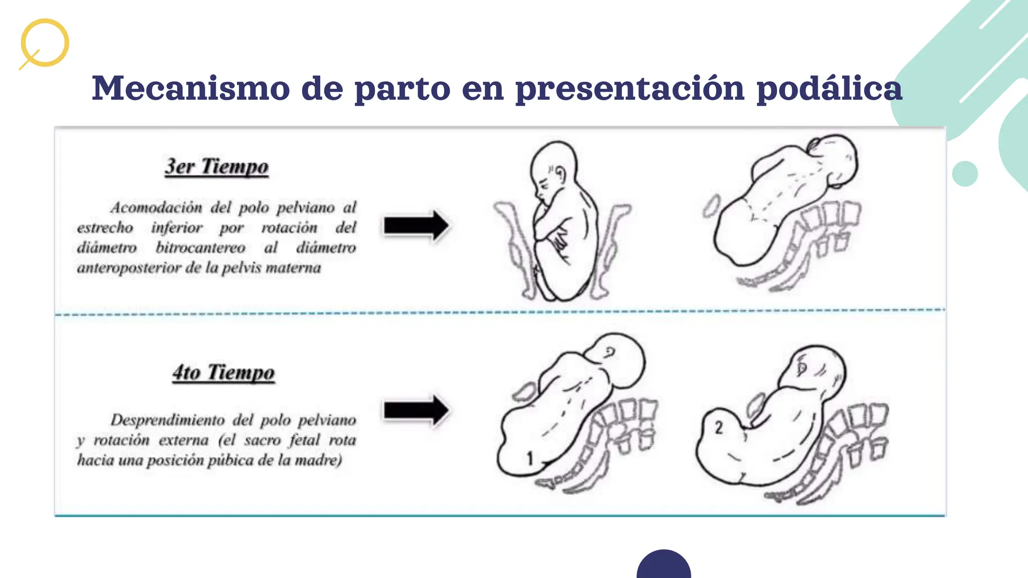 Presentación podálica y transversa y mecanismo de parto | PPTX ...