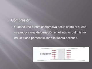 Principios biomecánicos de las fracturas | PPTX