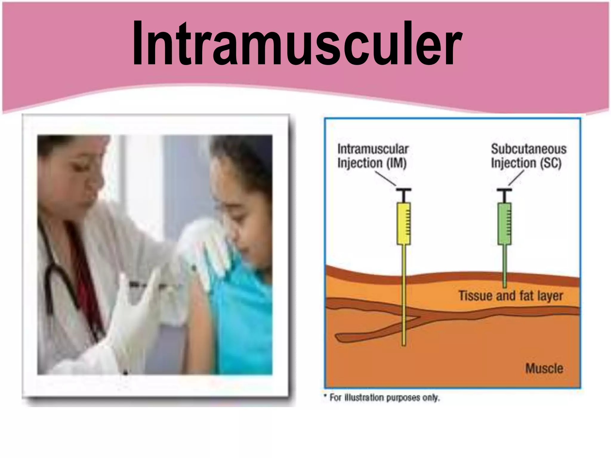 prinsip dan teknik pemberian obat oral, sublingual, ic, sc dan im | PPTX