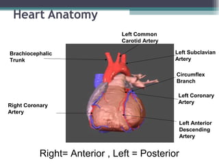 Open Heart Surgery Diagram
